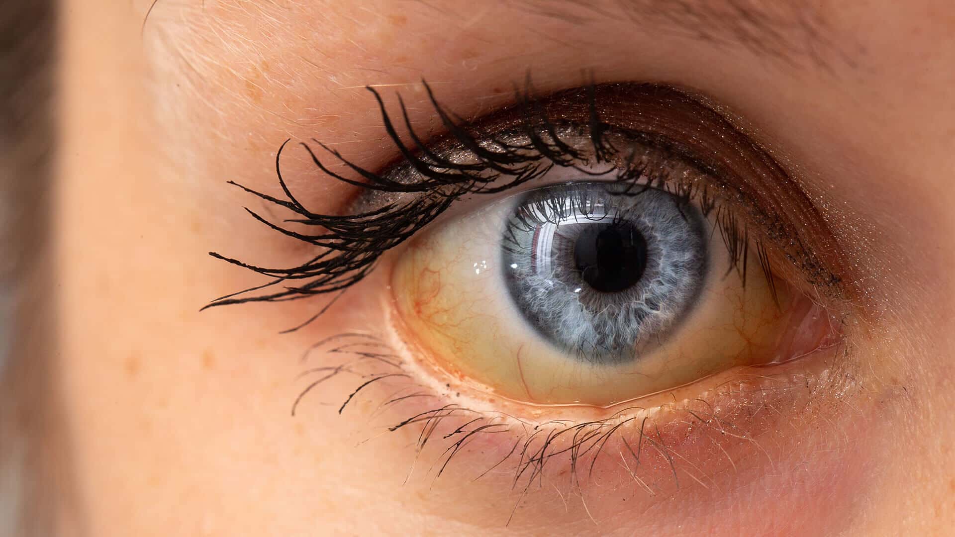 Augenfarben Liste - Wie entwickelt und verändert sie sich? (2023)