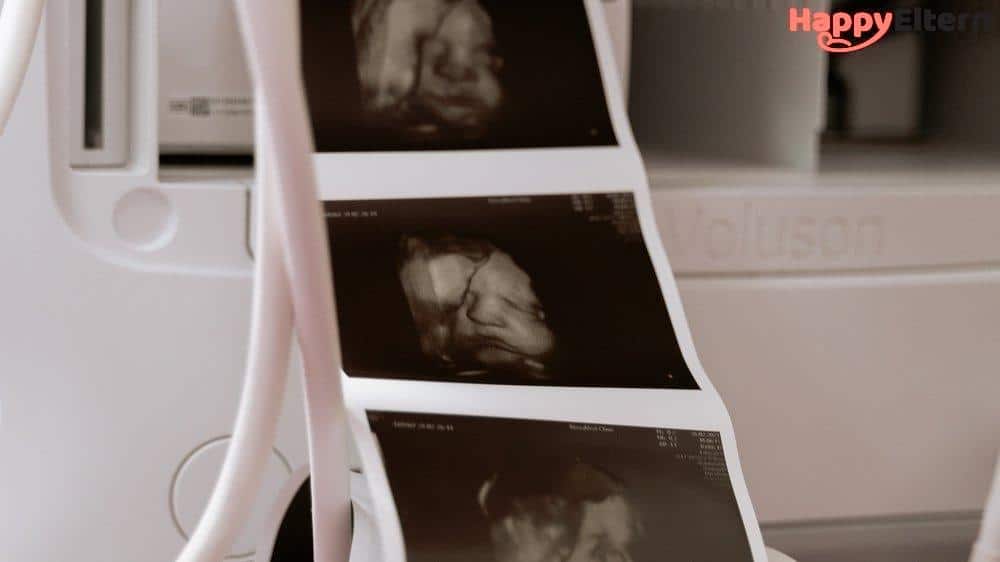 3D-Ultraschall 13 SSW Mädchen: Frühe Geschlechtserkennung und Erfahrungsberichte